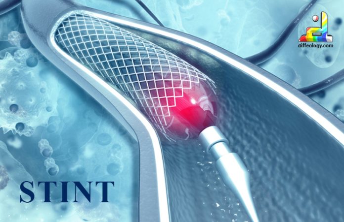 Difference Between Stent And Stint | Diffeology