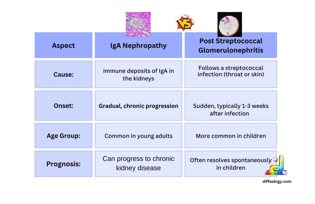 Difference Between IgA Nephropathy And Post-Streptococcal ...